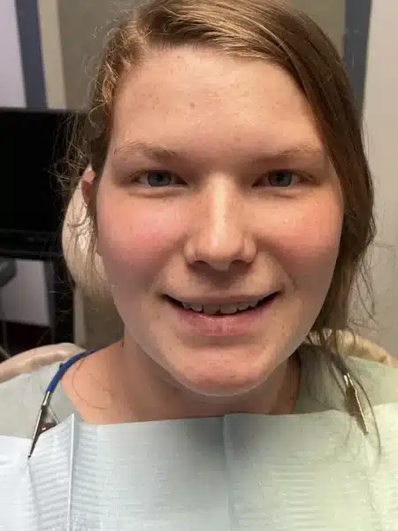 Smile Gallery - Peak DMD